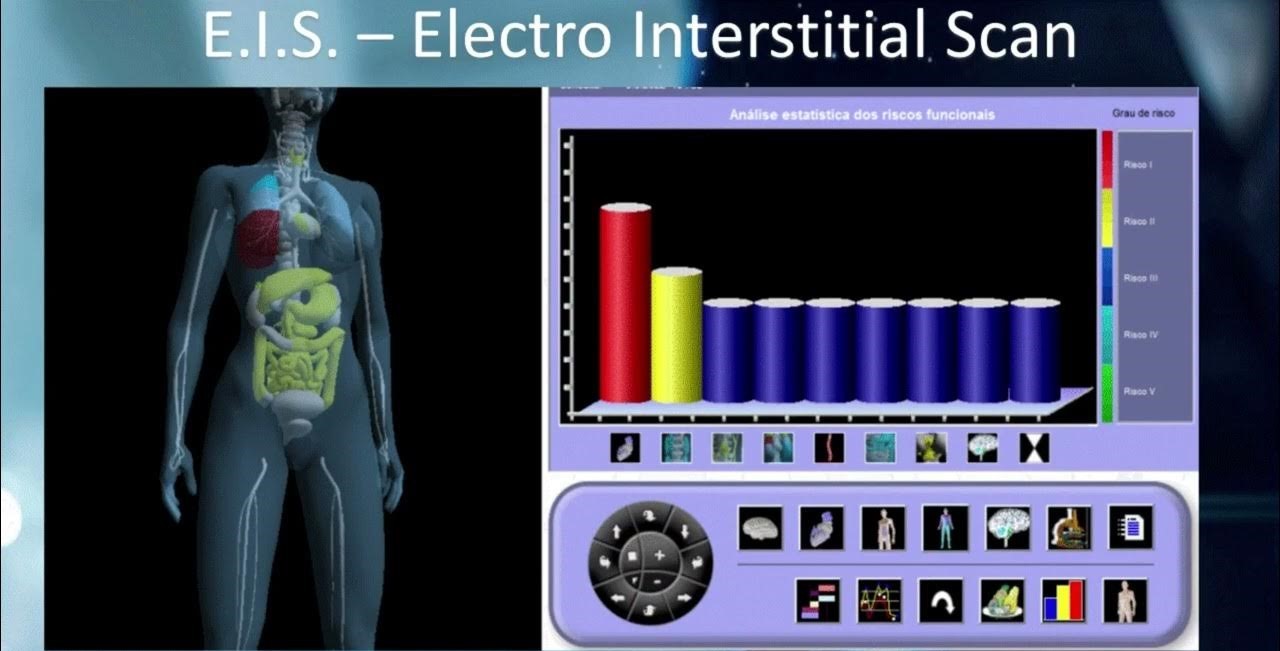 EIS (Electro interstitial scan) - BICOM Therapy